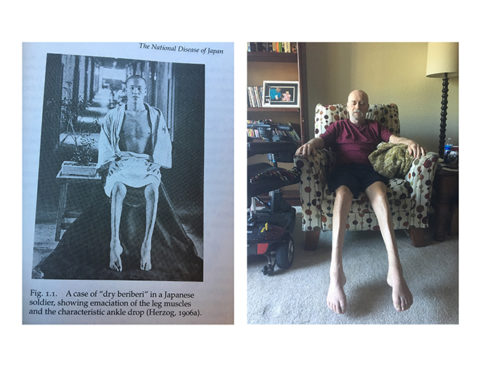 Teena Booth, Author at Hormones Matter